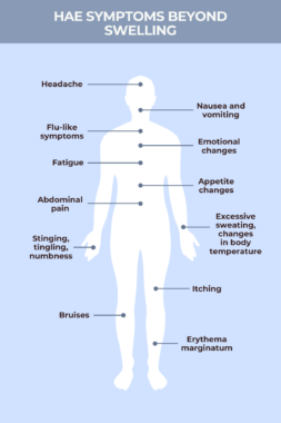 Beyond swelling: Other HAE symptoms you should know about | Angioedema News