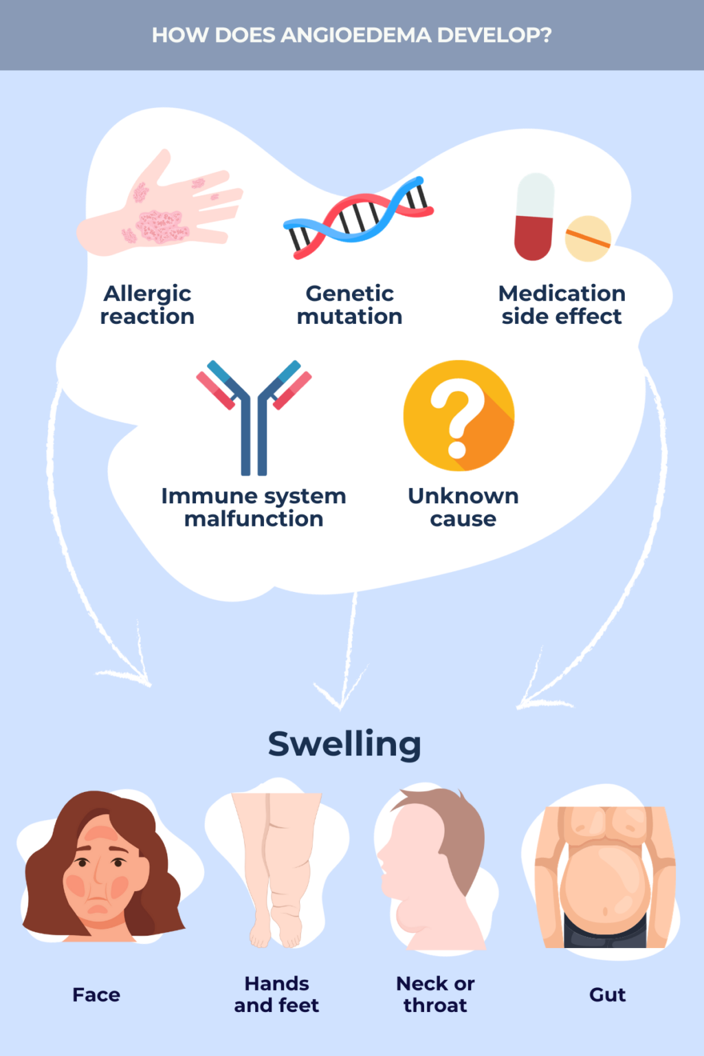What is angioedema and who does it affect? | Angioedema News